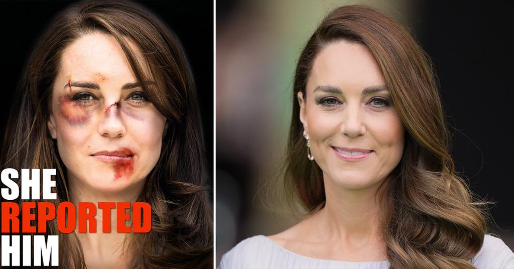 Fans Lash Out After Kate Middleton Is Used In Domestic Violence Poster ...
